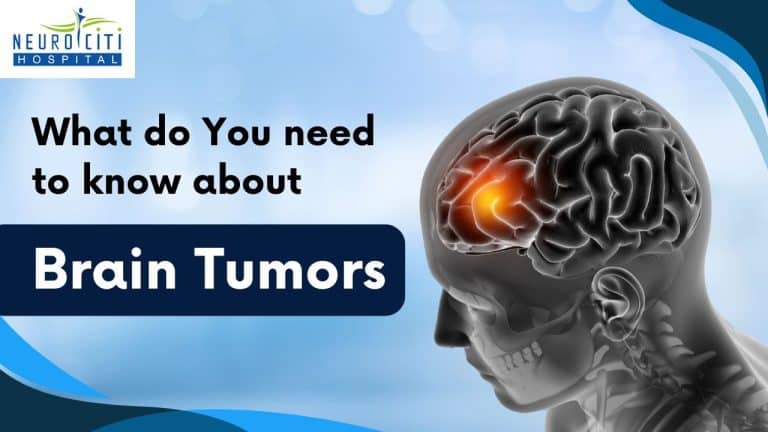 Brain Tumors: Key Facts You Should Know